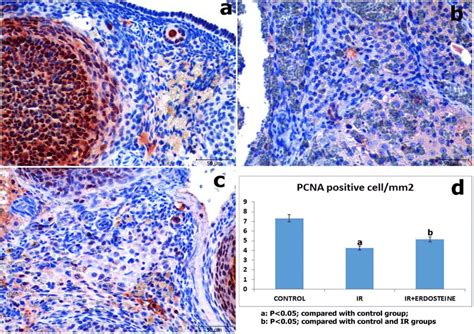 Pcna Staining A Control Group B Ischemiareperfusion Group