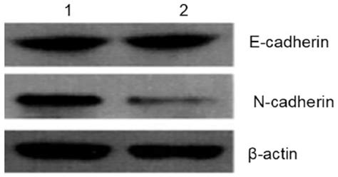 The Expression Of E Cadherin And N Cadherin After The Intervention 1