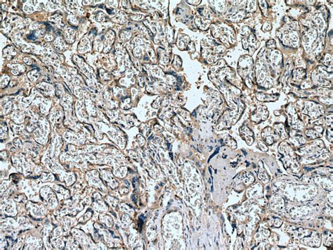 Slc19a1 Polyclonal Antibody 25958 1 Ap