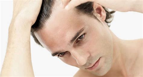 How To Prevent Men Hair Loss Guide By Experthairtransplant Expert