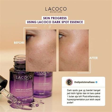 Jual Lacoco Dark Spot Essense 10ml Shopee Indonesia
