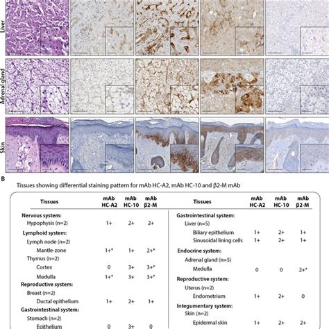 A Representative Tissue Samples Showing A Barely Staining Pattern For Download Scientific