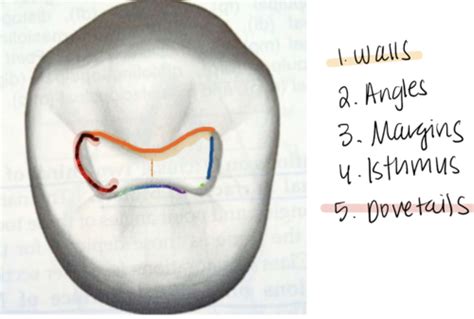 Cavity Classification And Nomenclature Flashcards Quizlet