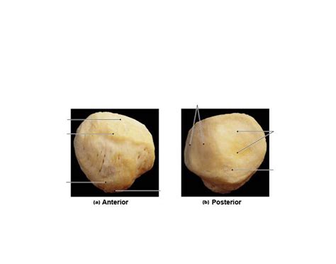 Patella Bone Labeled