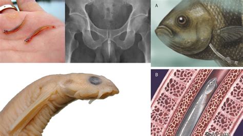 Pez Parasito Del Amazonas El Candiru Zucnys