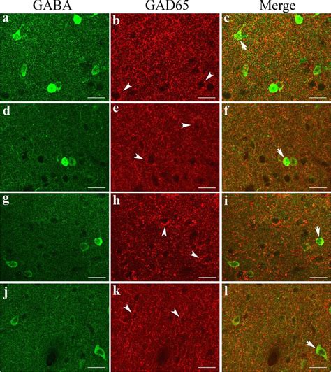 Fluorescence Double Labelling Of Gaba And The Gaba Synthesizing Enzyme Download Scientific