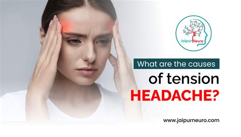 Moving Tension Headache At Rachel Vance Blog