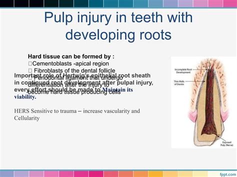 Apexogenesis And Apexification Pptx Dental Health Diseases And