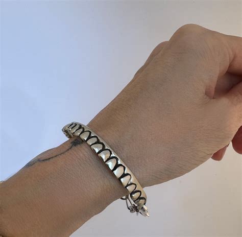 Tooth Bracelet Anomaly