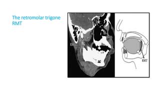 Normal Anatomy Of Buccal Mucosa And Cancer Pptx