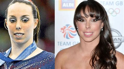 Beth Tweddles Plastic Surgery Are The Rumors True Celebs In Depth