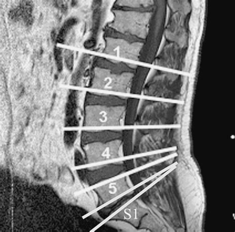 An Investigation Into The Use Of Mr Imaging To Determine The Functional
