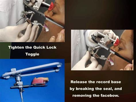 4 C Maxillo Mandibular Relation Records Face Bow Record And Transfer