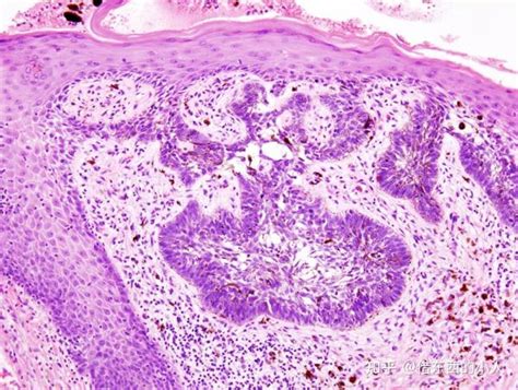 染色背景知识（一）不同器官he染色差别 知乎