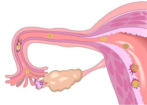 Infertility Symptoms Understanding The Signs Harvest Infertility Care Ltd Best Ivf Centre