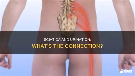Sciatica And Urination Whats The Connection Medshun