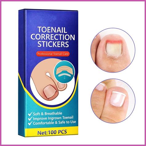 Toenail Patch Ingrown Toenail Corrector Strips 100pcs Safe Ingrown Toe