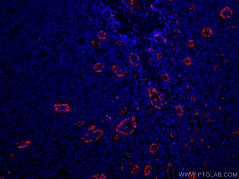 Cd31 Antibody Cl594 66065 Proteintech