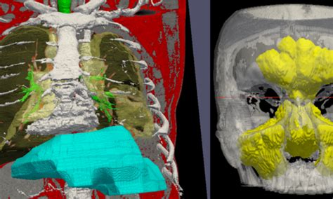 What Is The Hu Of Bone Telerad Physics Teaching