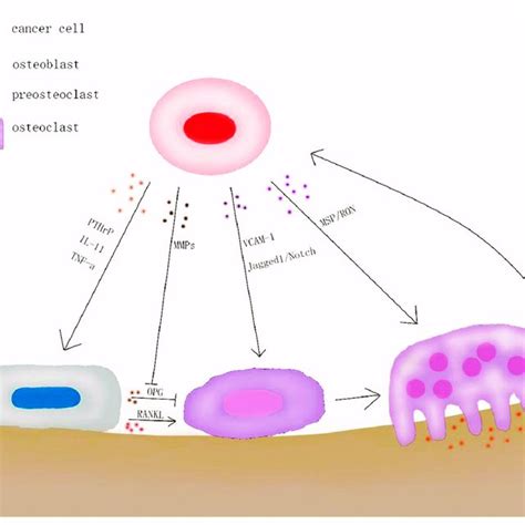Comparison Of Bone Tumor Microenvironment In Metastasis Versus Sarcoma Download Scientific