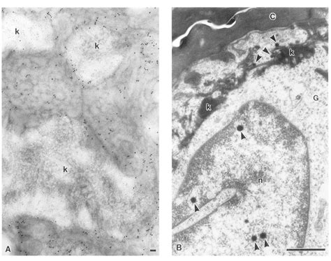 Figure 4 From Immunoelectron Microscopic Analysis Of Cornified Cell