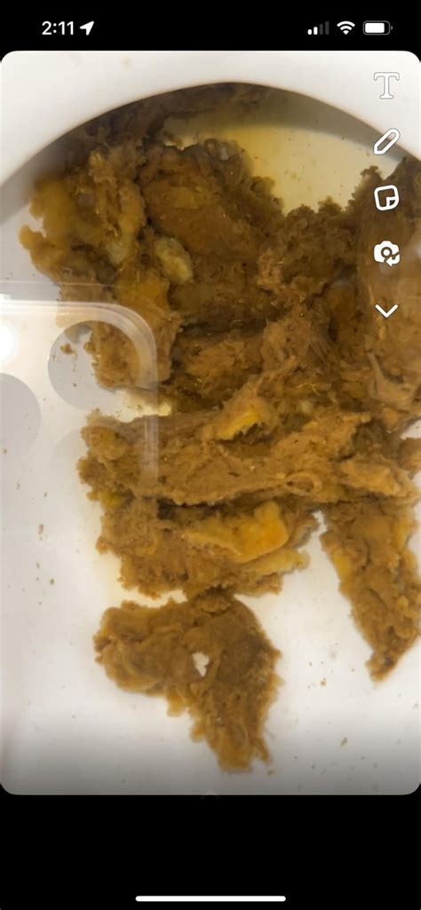 21m Whose Has Had Multiple Tests With No Answers Lately I Have Been Having Yellow Chunks In