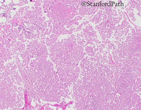 Choroid Plexus Histology