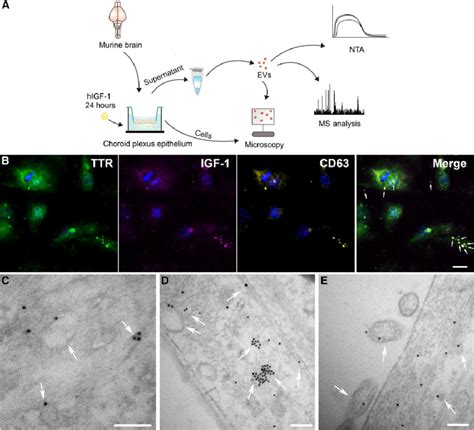 Localization Of Igf 1 In Neonatal Primary Murine Chpe Cells A