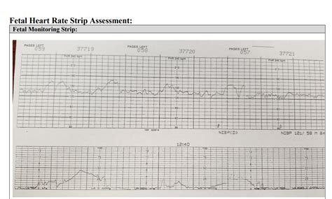 [solved] Fetal Heart Rate Strip Assessment What Is The Interpretation
