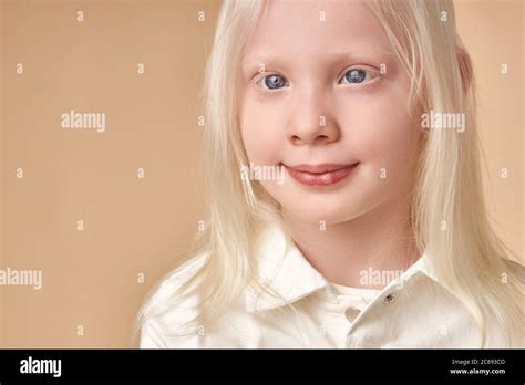 Adorable Albino Girl 7 9 Years Old Posing At Camera Isolated Shy
