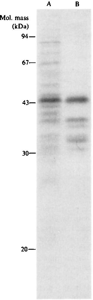 Figure 1 From The Periplasmic Flagella Of Serpulina Treponema Hyodysenteriae Are Composed Of