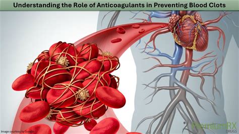 Understanding The Role Of Anticoagulants In Preventing Blood Clots