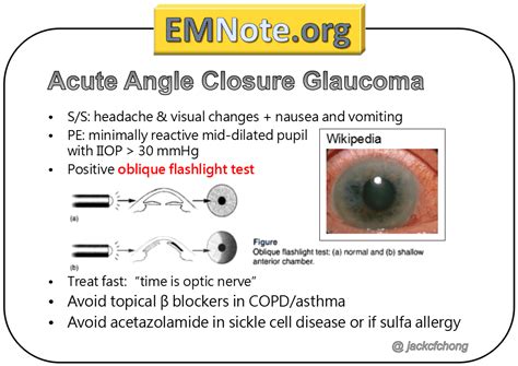 Lens Replacement Surgery For Acute Angle Glaucoma At Emma Gibney Blog