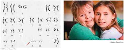 Genetics Module 6 Diagrams Flashcards Quizlet