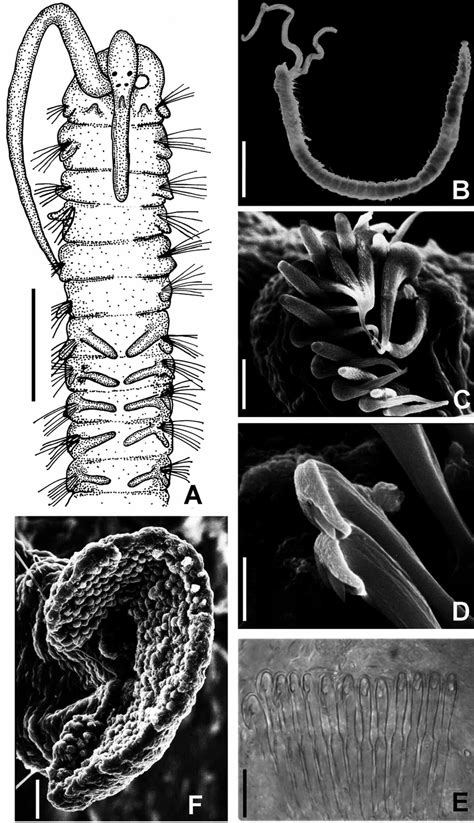 Pseudopolydora Paucibranchiata A Anterior End Dorsal View
