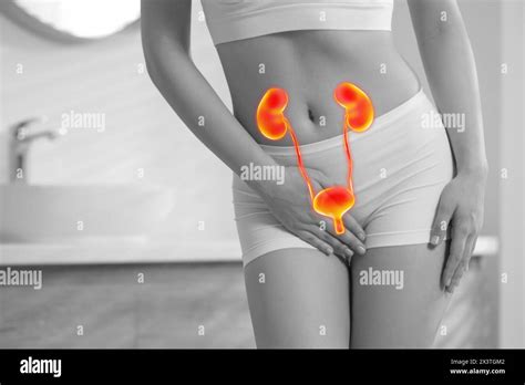 Woman Suffering From Cystitis At Home Closeup Illustration Of Urinary