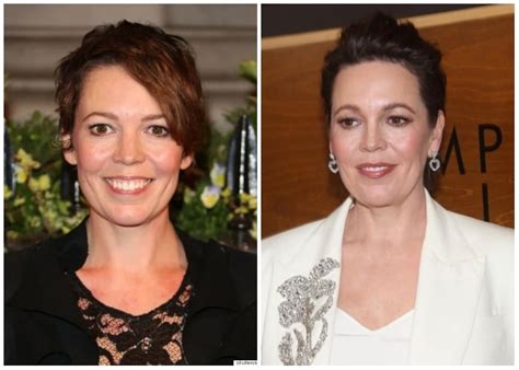 Shocking Transformations Revealed Celebrity Before And After Plastic