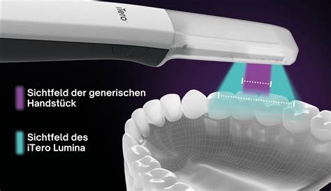 Flemming Intraoralscanner Intraoralscanner Zrrml