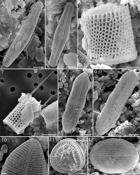 Scanning Electron Microscope Sem Microphotographs Figs 4 5 Download Scientific Diagram