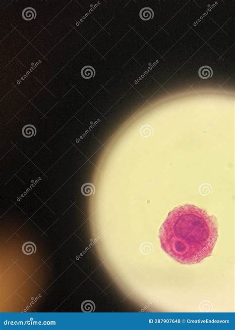 Crytpococcus Neoformans Encapsulated Organism Inside Macrophage Stock
