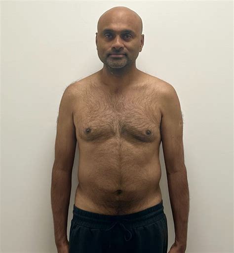 To Better Save Lives This Doctor Prepped Foods And Prioritized Exercise