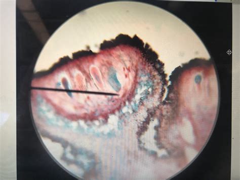 Lichen Thallus Diagram Quizlet