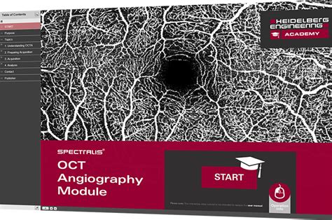 News Heidelberg Engineering Gmbh