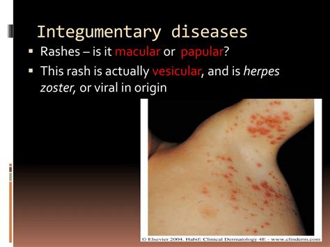 Ppt Selected Integumentary System Diseases And Conditions Powerpoint