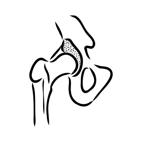 Hip Joint Vector Sketch 8687224 Vector Art At Vecteezy