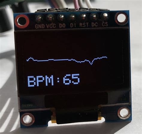Oled With Pulse Sensor Fails To Display Properly Displays Arduino Forum