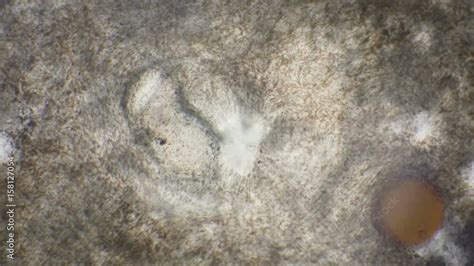 Body Of A Living Leech Worm Under The Microscope Stock Video Adobe Stock