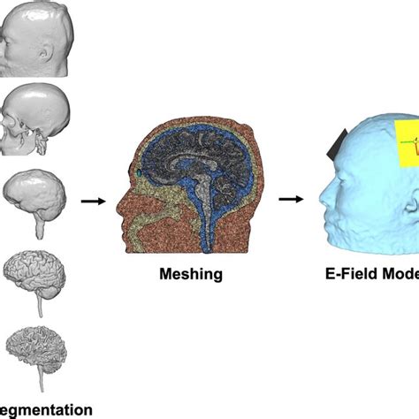 E Field Modeling Pipeline E Field Modeling Entails Five Main Steps Download Scientific