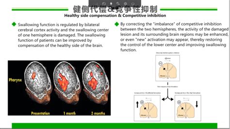 Chapter 4 Series Research And Clinical Application Of Tms On Central