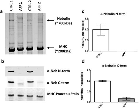 Nebulin Is Drastically Reduced In Skeletal Muscles With S8042x A